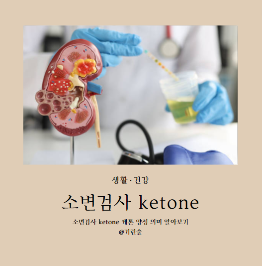 소변검사 Ketone 케톤 양성 의미 요케톤체 알아보기 네이버 블로그