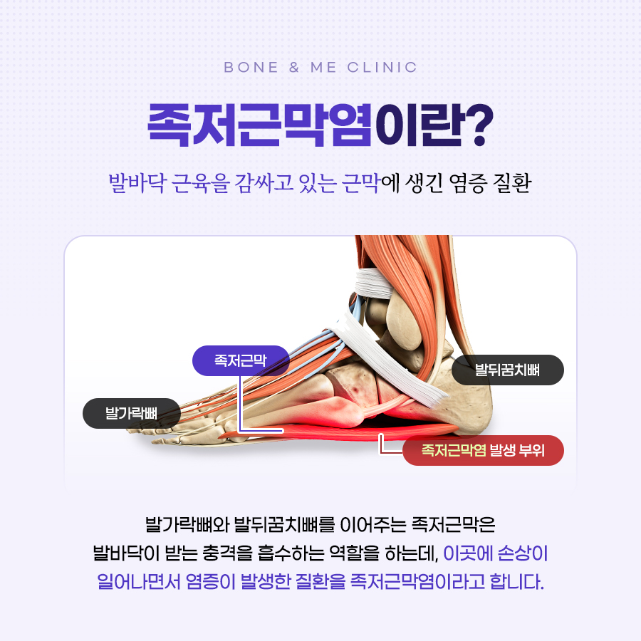 역삼동정형외과 대표적인 족부질환 족저근막염 네이버 블로그