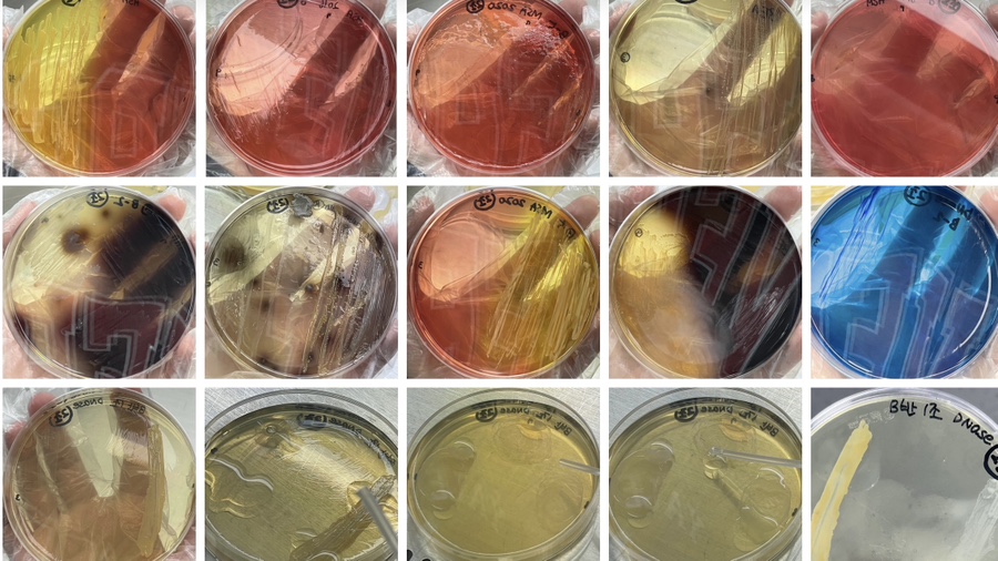 임상병리과 임상미생물학 MSA agar, DNase agar, BEA agar : 네이버 블로그