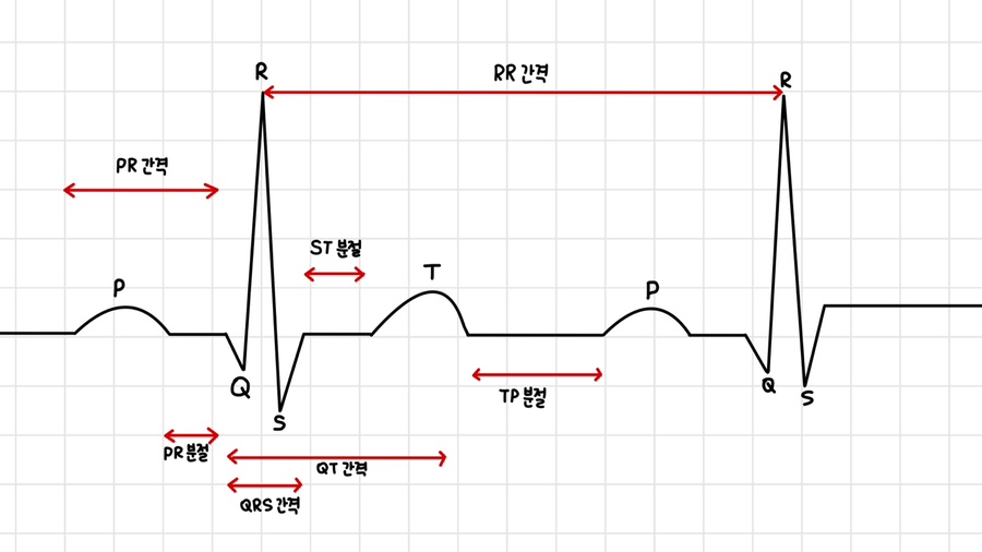 임상생리학 심전도 정리 : 네이버 블로그