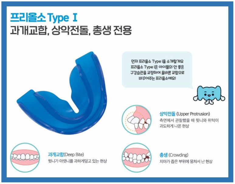 프리올소(preortho) 장치 종류 (반대교합, 개방교합) 제1편 : 네이버 블로그