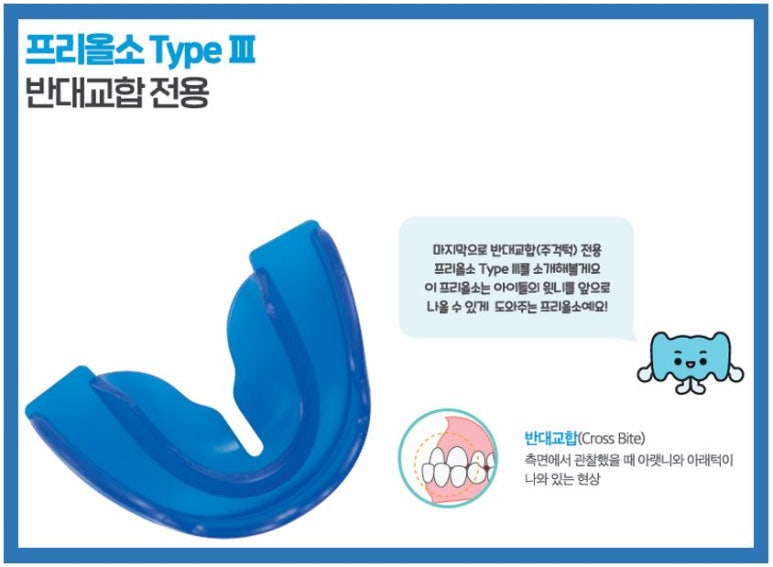 프리올소(preortho) 장치 종류 (반대교합, 개방교합) 제1편 : 네이버 블로그