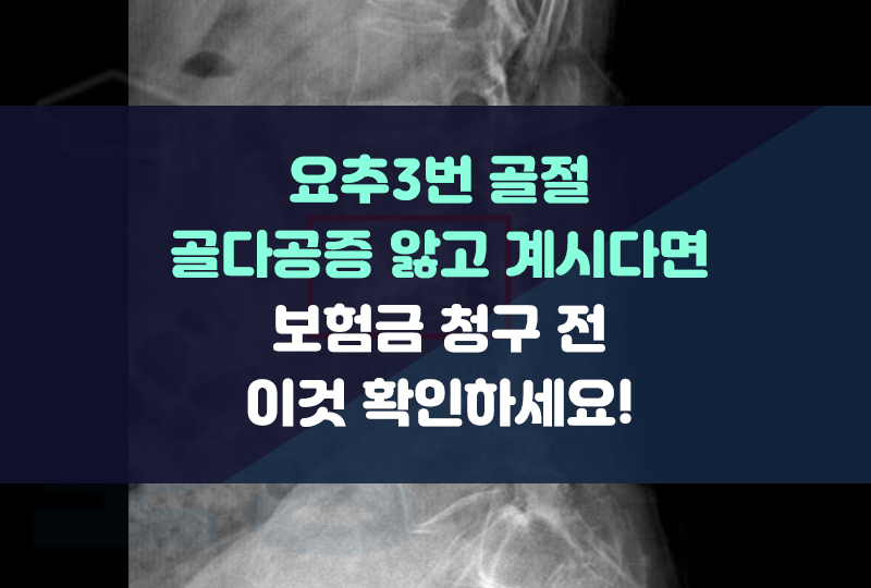 요추3번골절 골다공증 보험금 청구 후기 후유장해 보상조건 네이버 블로그