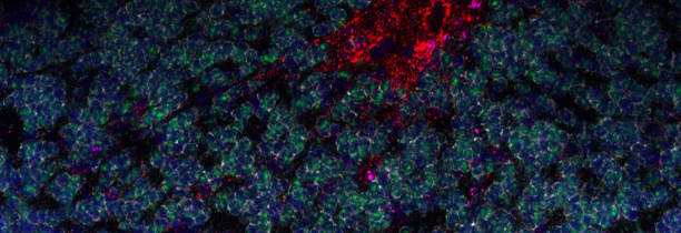 [ACD RNA-ISH] Gene therapy: AAV biodistribution : 네이버 블로그