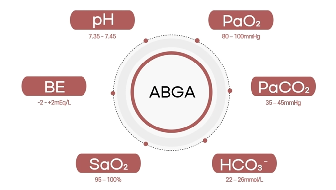 ABGA 동맥혈가스검사 (Arterial blood gas analysis) 구성요소 및 정상수치 VBGA와 차이, 1편 ...