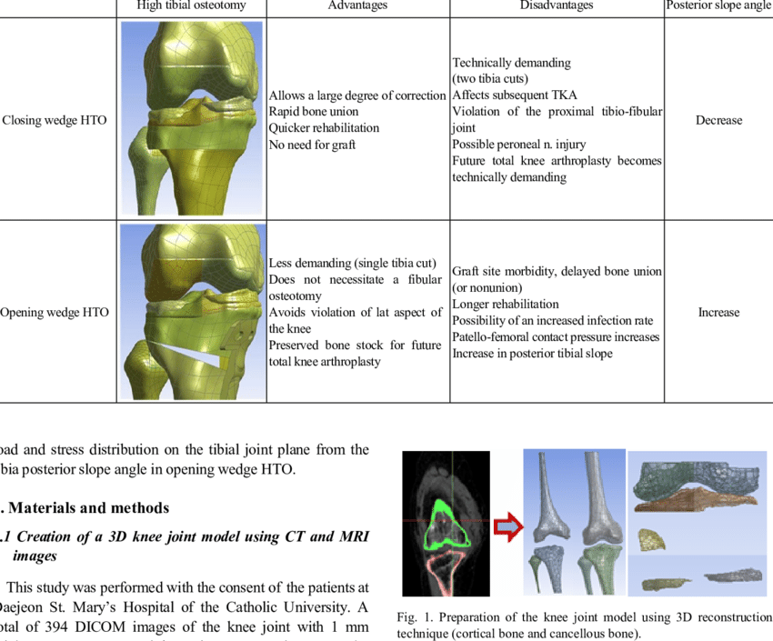 OS) HTO(High Tibia Osteotomy) : 네이버 블로그