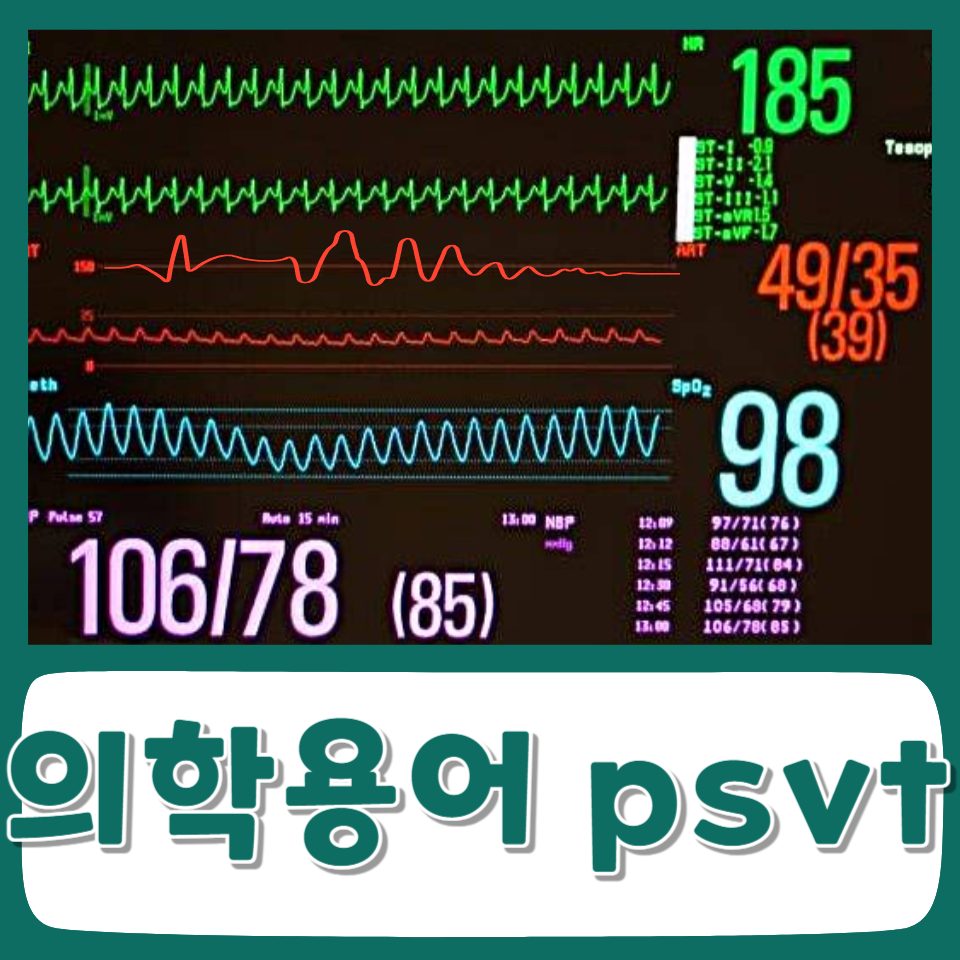 의학용어 psvt 응급 처치 원인 증상 svt 차이 : 네이버 블로그