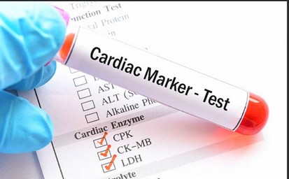 심장효소검사(Cardiac Enzyme Marker) CK-MB와 Troponin T에 대해서 알아봐요~ : 네이버 블로그