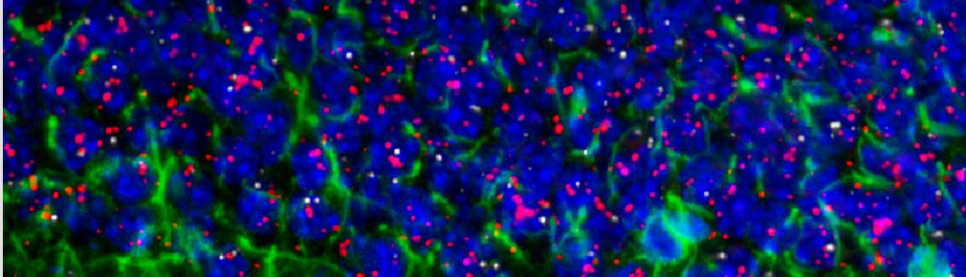 [ACD] RNAscope™ - Cytokine 탐지 및 시각화 : 네이버 블로그