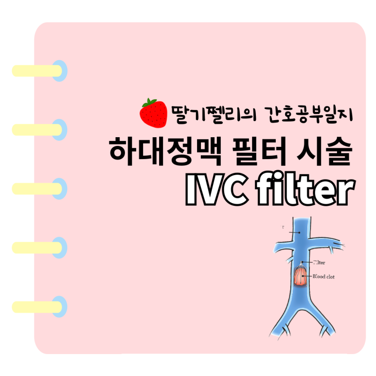 IVC filter 하대정맥 필터| 의학용어, 목적, 제거, 부작용, 간호 : 네이버 블로그