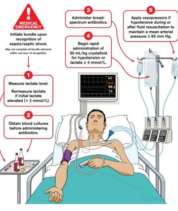 패혈증 1시간이내 골든타임 지키기 3분간호 sepsis 1hour bundle : 네이버 블로그