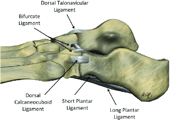 쇼파르 관절(Chopart's joints)🦶 : 네이버 블로그