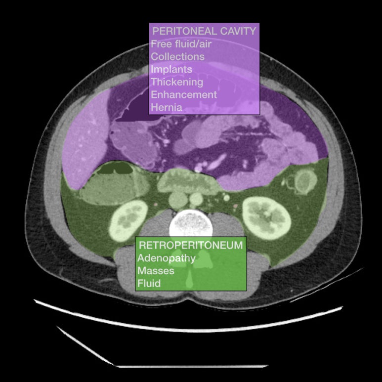 복부 CT 판독하는 방법: 복부의 기초 해부학 - anatomy of the abdomen, introduction : 초심자의 ...