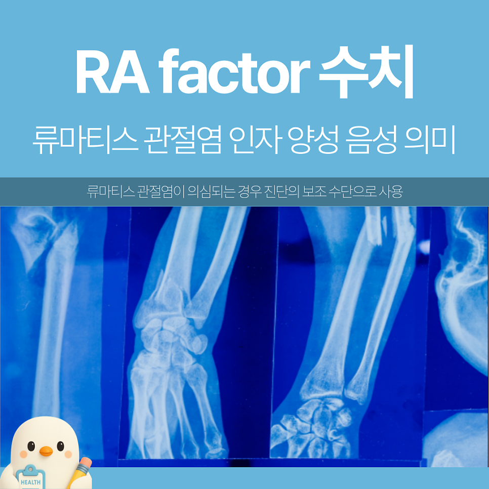 RA factor 수치 류마티스 관절염 인자 양성 음성 의미 : 네이버 블로그