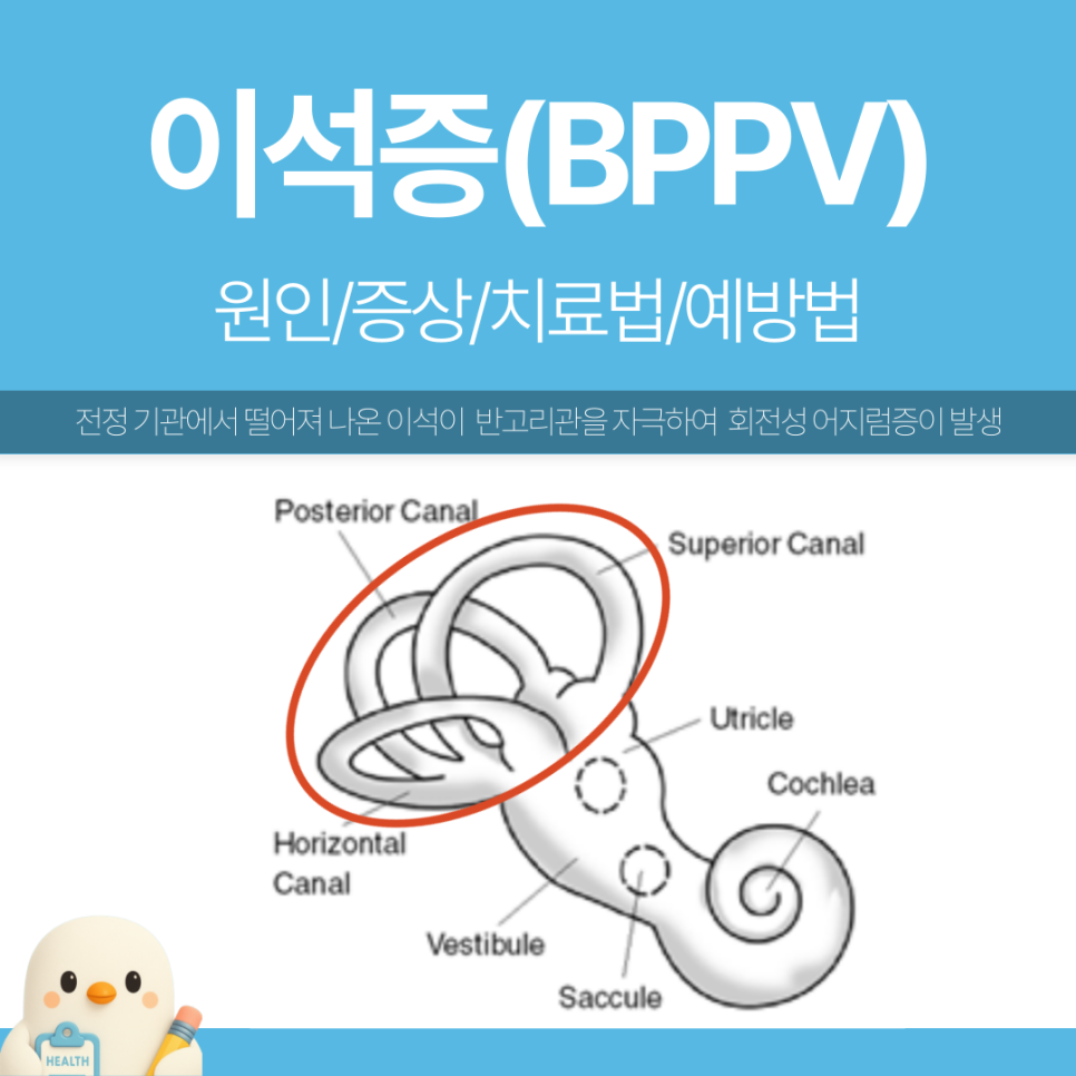 의학용어 BPPV 이석증 증상 원인 치료 한눈에! : 네이버 블로그