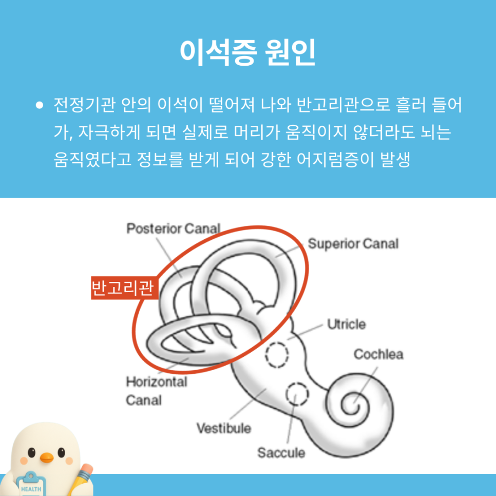 의학용어 BPPV 이석증 증상 원인 치료 한눈에! : 네이버 블로그