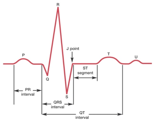 [ER간호] EKG 12 Lead 와 주요 부정맥 : 네이버 블로그