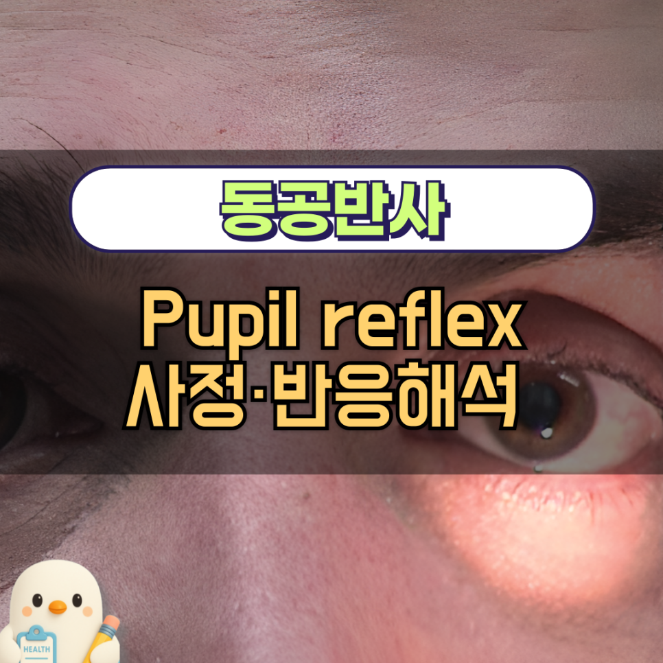 Pupil reflex 뜻 사정 방법:동공반사 반응 해석 : 네이버 블로그