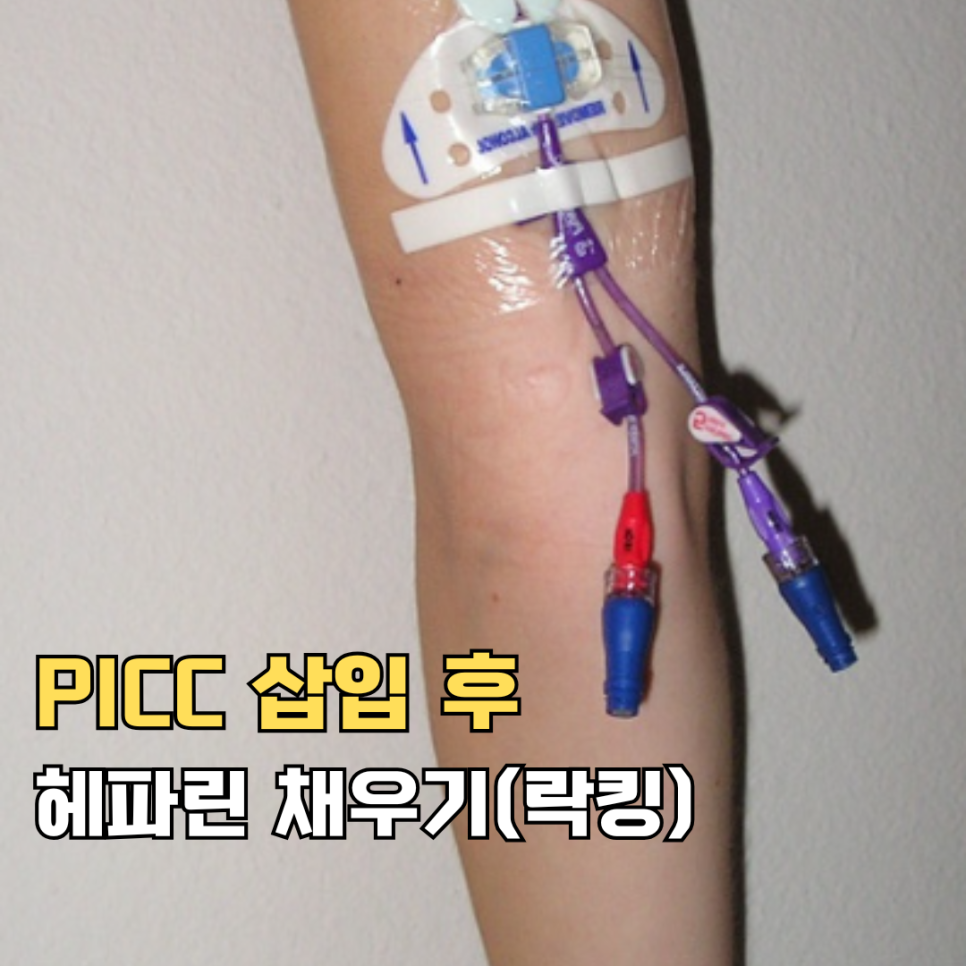 PICC 삽입 후 헤파린 채우기(락킹), 꼭 알아야 할 관리법 : 네이버 블로그