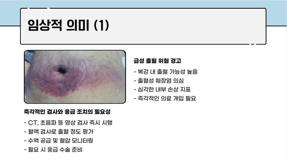 쿨렌 징후(Cullen sign)에 대해서 자세히 알아봐요~ : 네이버 블로그