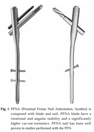 PFNA : 네이버 블로그