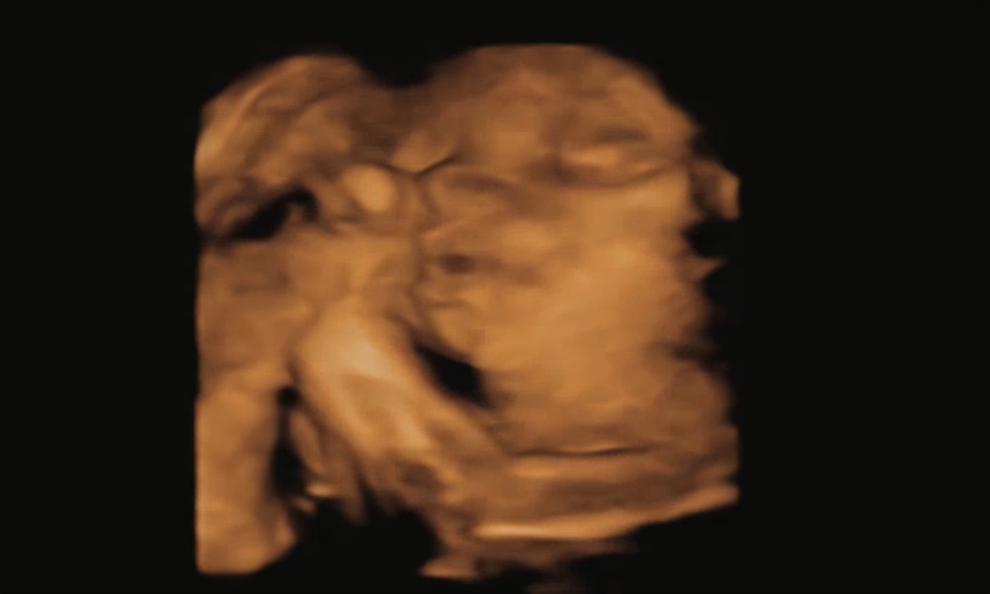 임신일기 27주 | 27주 입체초음파, 속초여행, 운전자보험 : 네이버 블로그