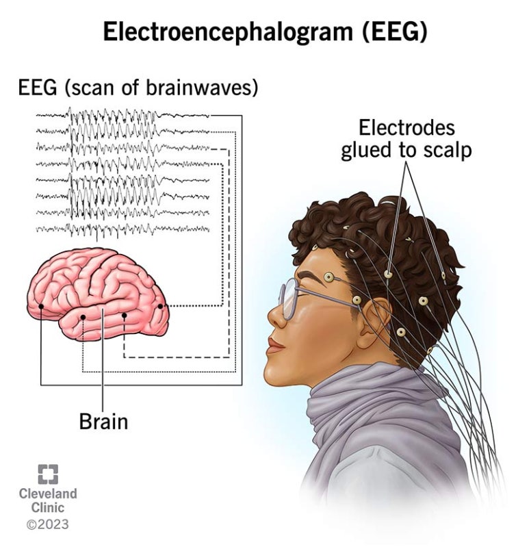 전기와 자기로 본 뇌 : EEG, EOG, EMG, MEG : 네이버 블로그