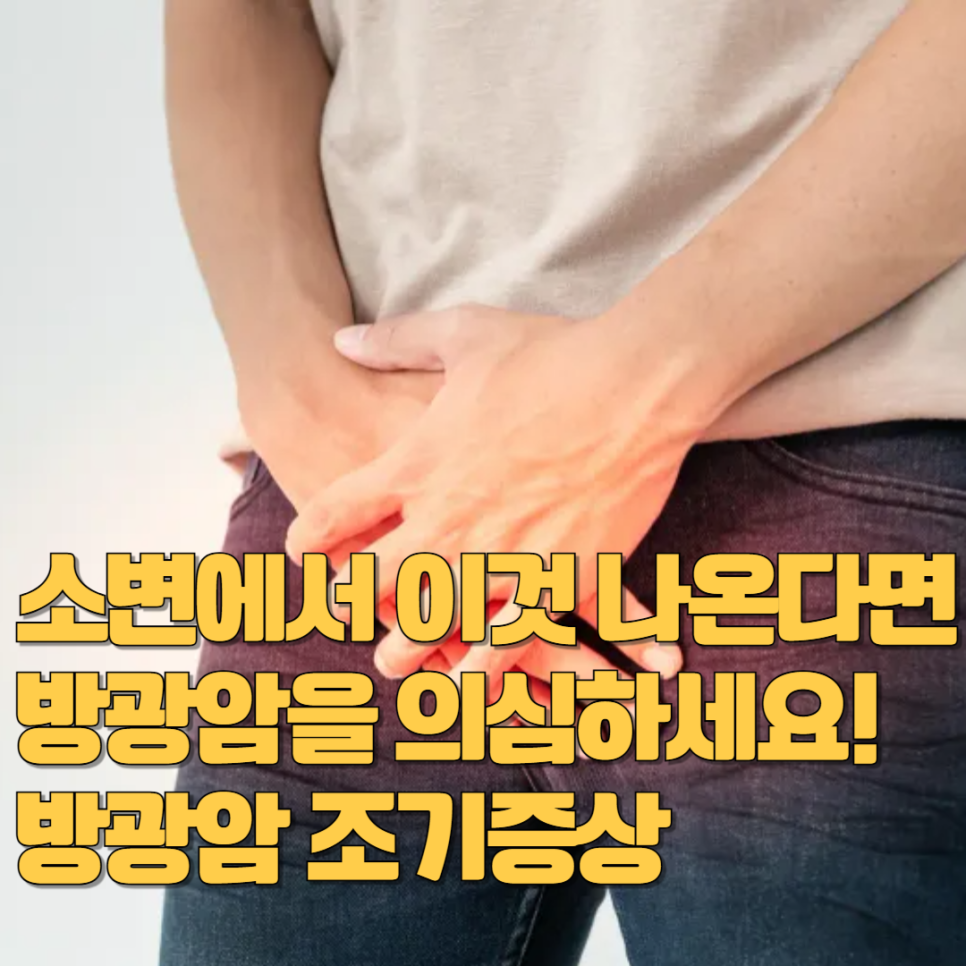소변에서 이것 나온다면, 방광암을 의심하세요! 방광암 조기증상 : 네이버 블로그