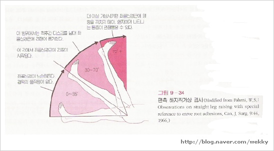 하지직거상검사(SLRT) 의 의미 : 네이버 블로그
