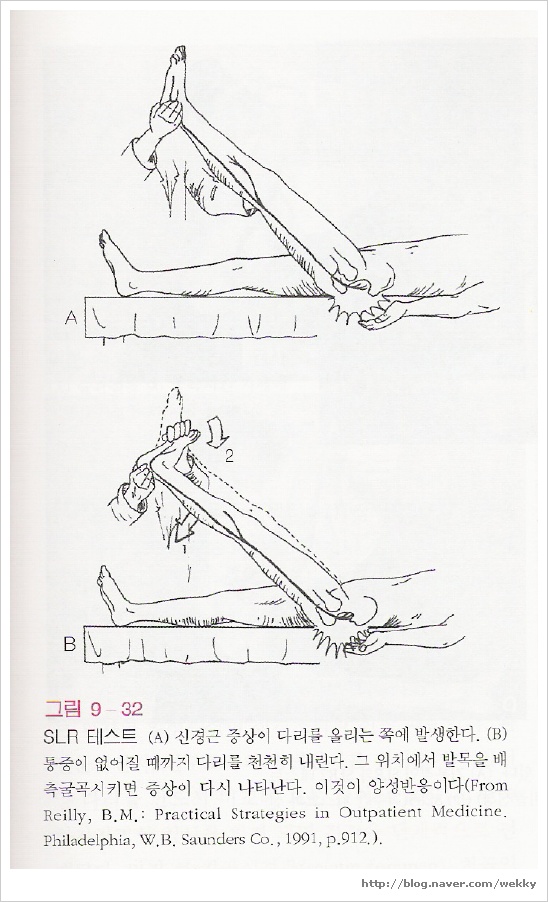 하지직거상검사(SLRT) 의 의미 : 네이버 블로그