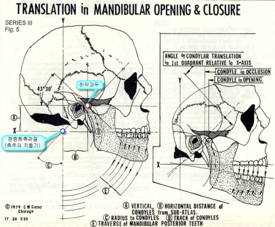 턱관절(악관절, TMJ)로 어떻게 전신(온 몸)을 치료할 수 있나요? : 네이버 블로그